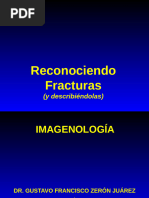 Clasificacion de Fernandez para Fracturas Distales de Radio: Issac ...