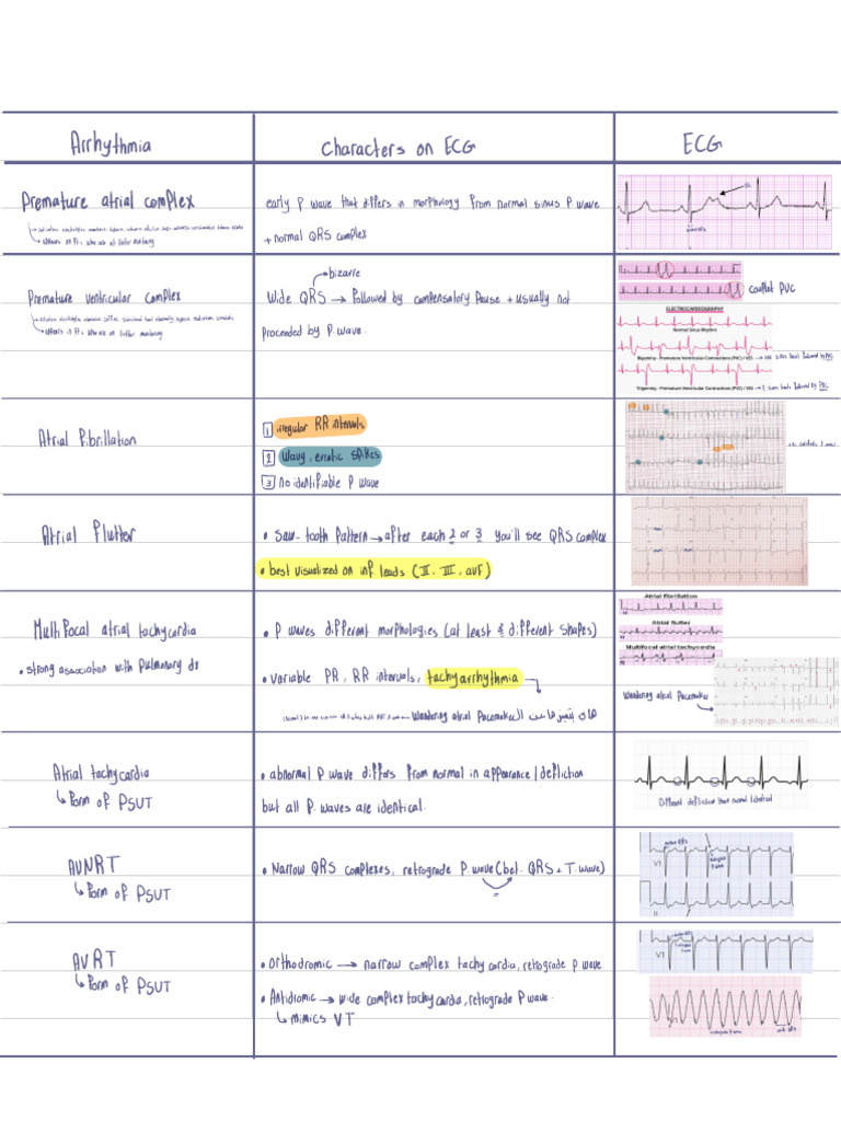 ECG Changes in Arrhythmias | PDF | Electrocardiography | Cardiology