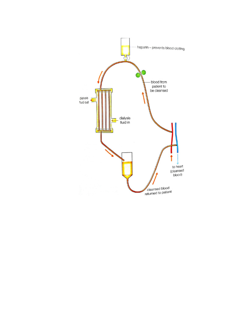 Lloydysha Augustine - Dialysis Worksheet | PDF