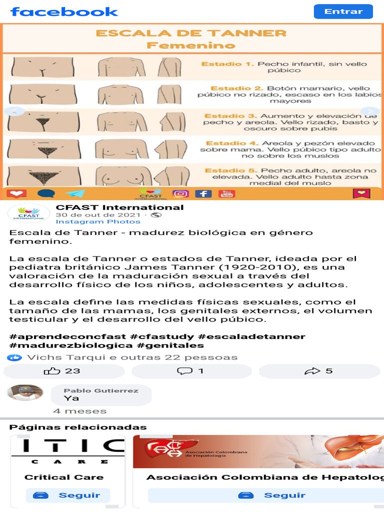 Escala de Tanner - Madurez Biológica... - CFAST International | PDF