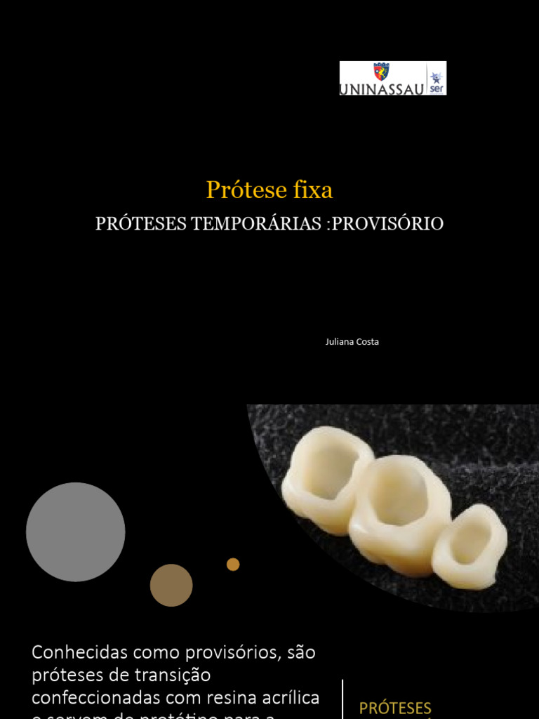 Prótese Fixa: Provisórios e Técnicas | PDF | Dente humano | Prótese