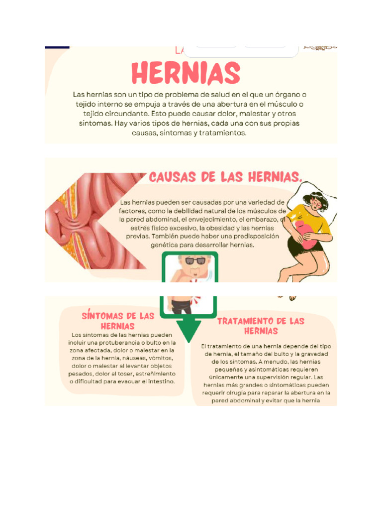 Hernias | PDF