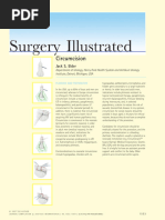 Circumcision Surgery: Recovery Insights | PDF | Surgery | Medical ...