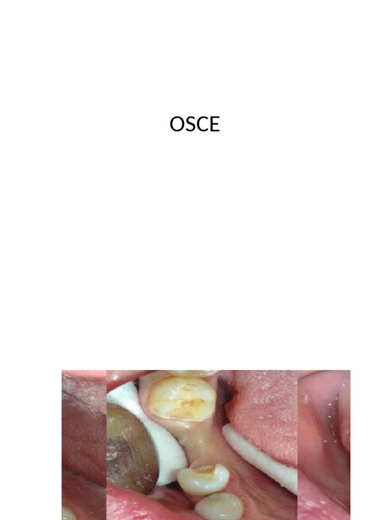 OSCE | PDF