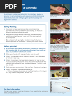 Saf-T-Intima Cannula Insertion Guide | PDF | Intravenous Therapy | Syringe