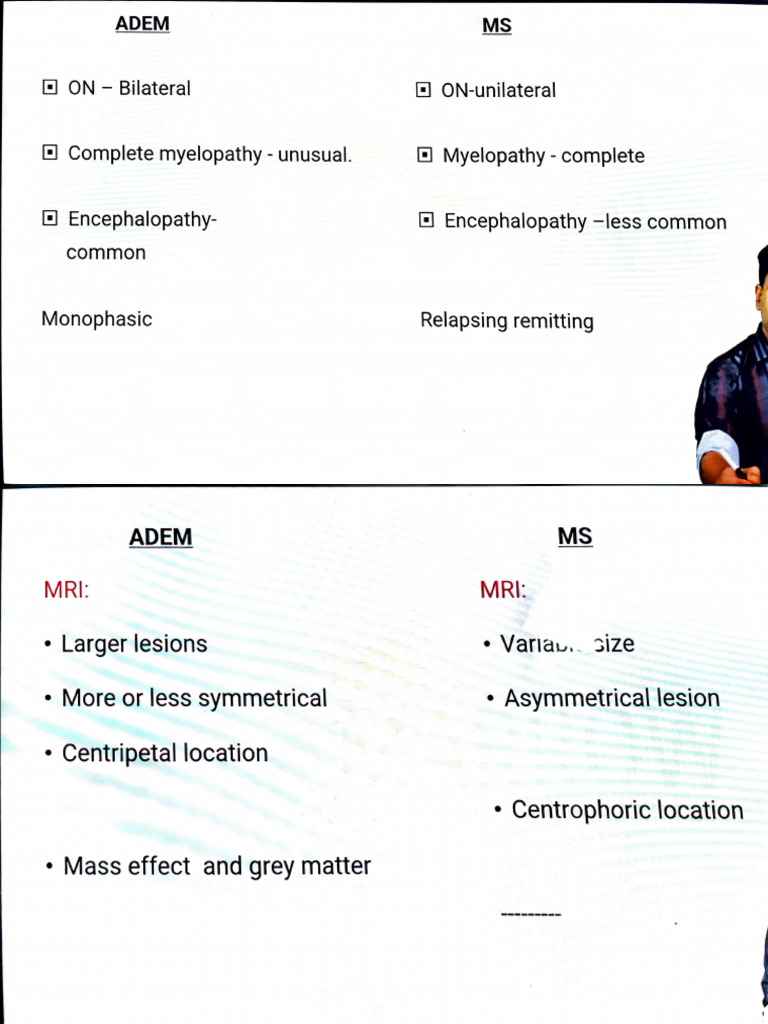 ADEM Vs MS | PDF