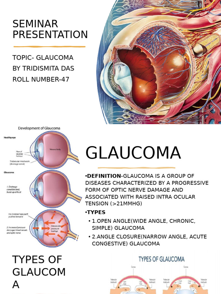 Glaucoma 2 | PDF