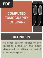 ESR Modern Ebook 04 v2 | PDF | Ct Scan | Imaging
