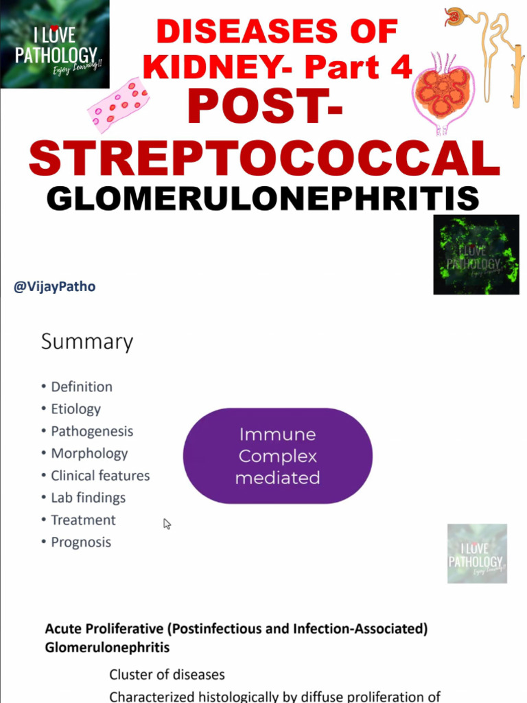 Post-Strep Glomerulonephritis Guide | PDF | Streptococcus | Diseases ...