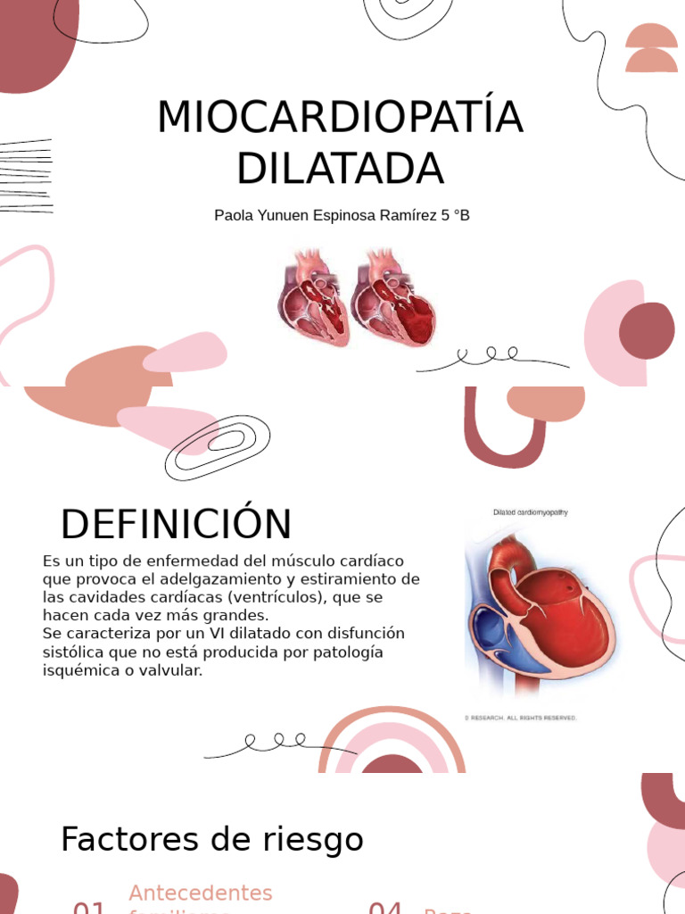 miocardiopatia dilatada | PDF | Hipertensión | Corazón