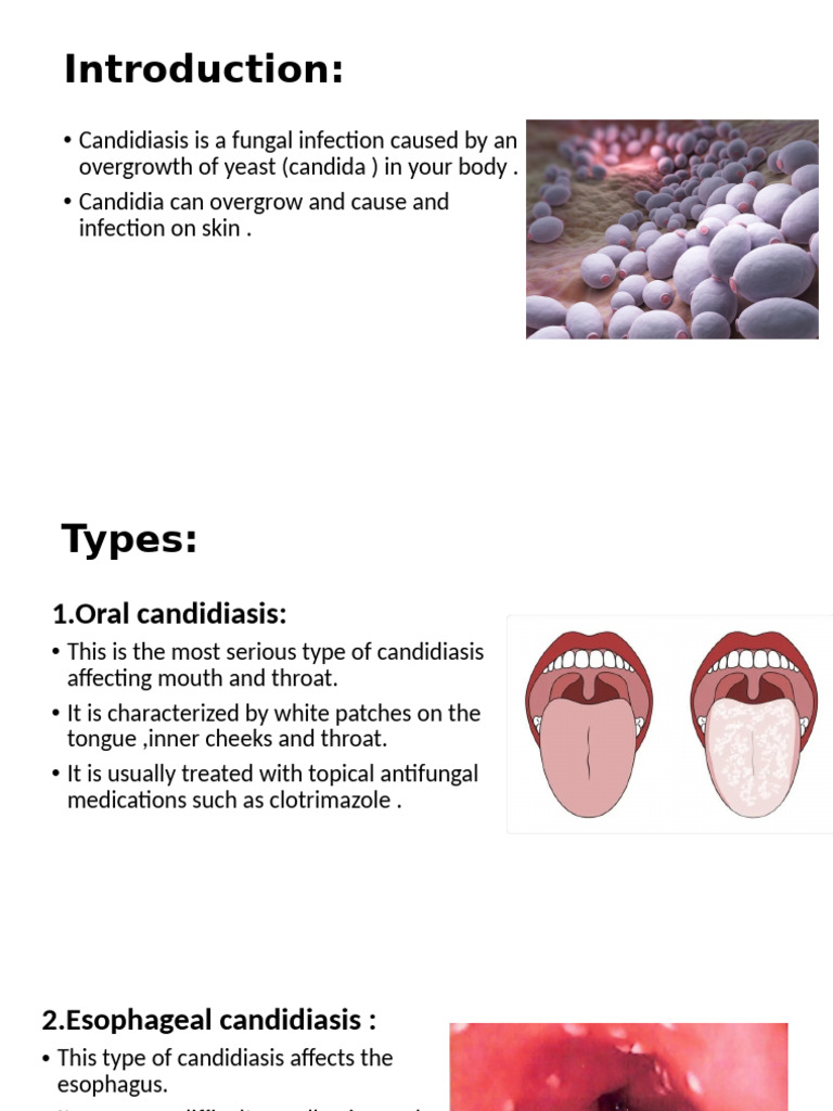 Candidiasis Types and Treatments | PDF | Candidiasis | Microbiology