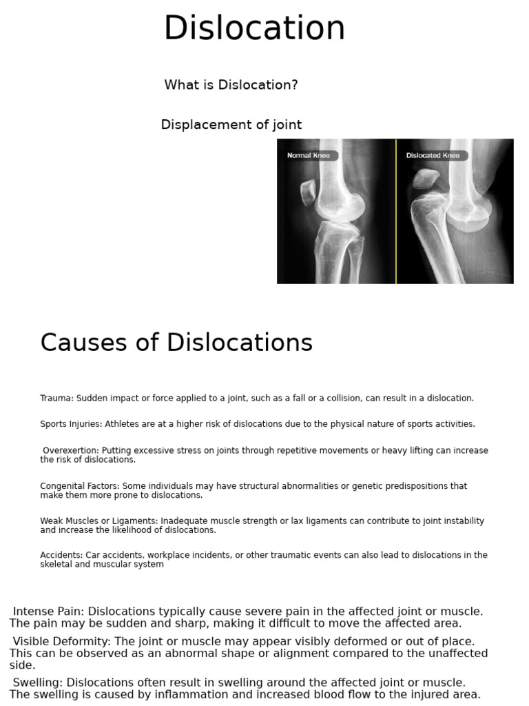 Dislocation | PDF | Paresthesia | Pain