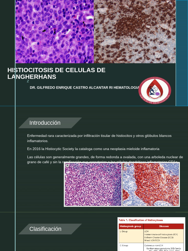 Histiocitosis de Celulas de Langherhans | PDF | Especialidades Medicas ...