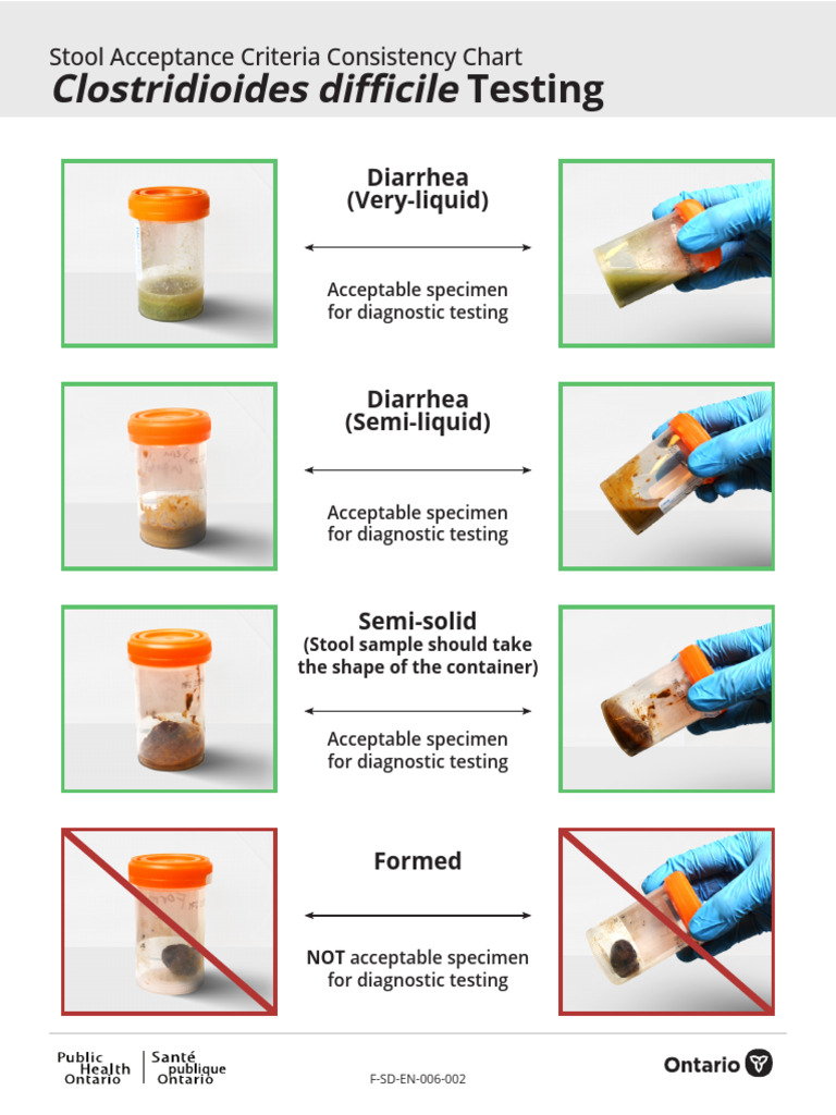Stool Consistency Acceptance Cdiff | PDF