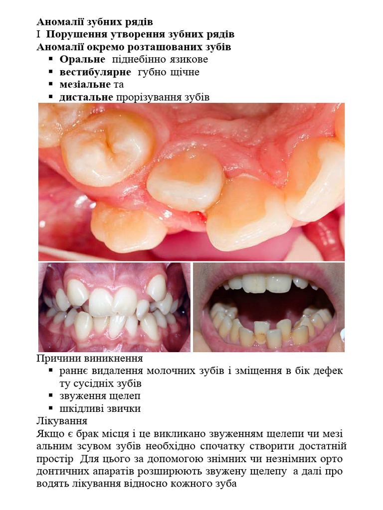 Anomalii Zubnyh Ryadiv | PDF