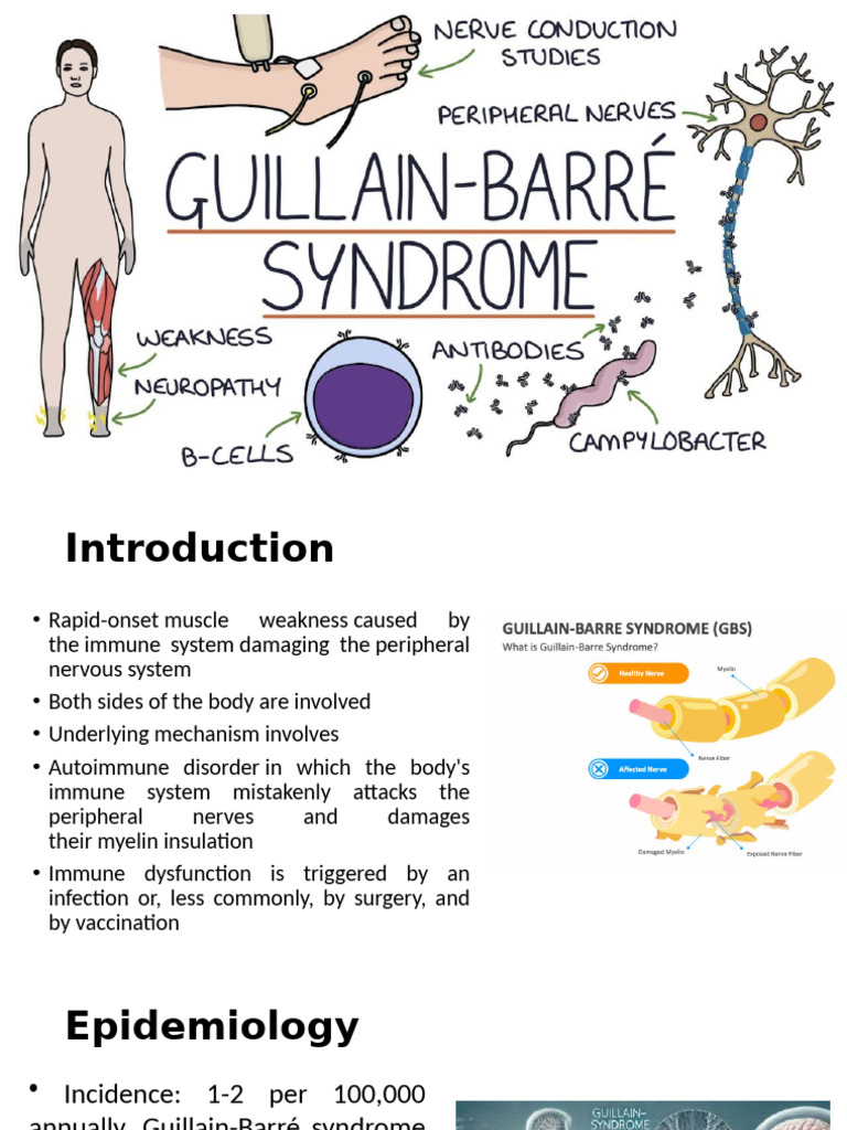 Guillain–Barré Syndrome | PDF | Diseases And Disorders | Medical Specialties