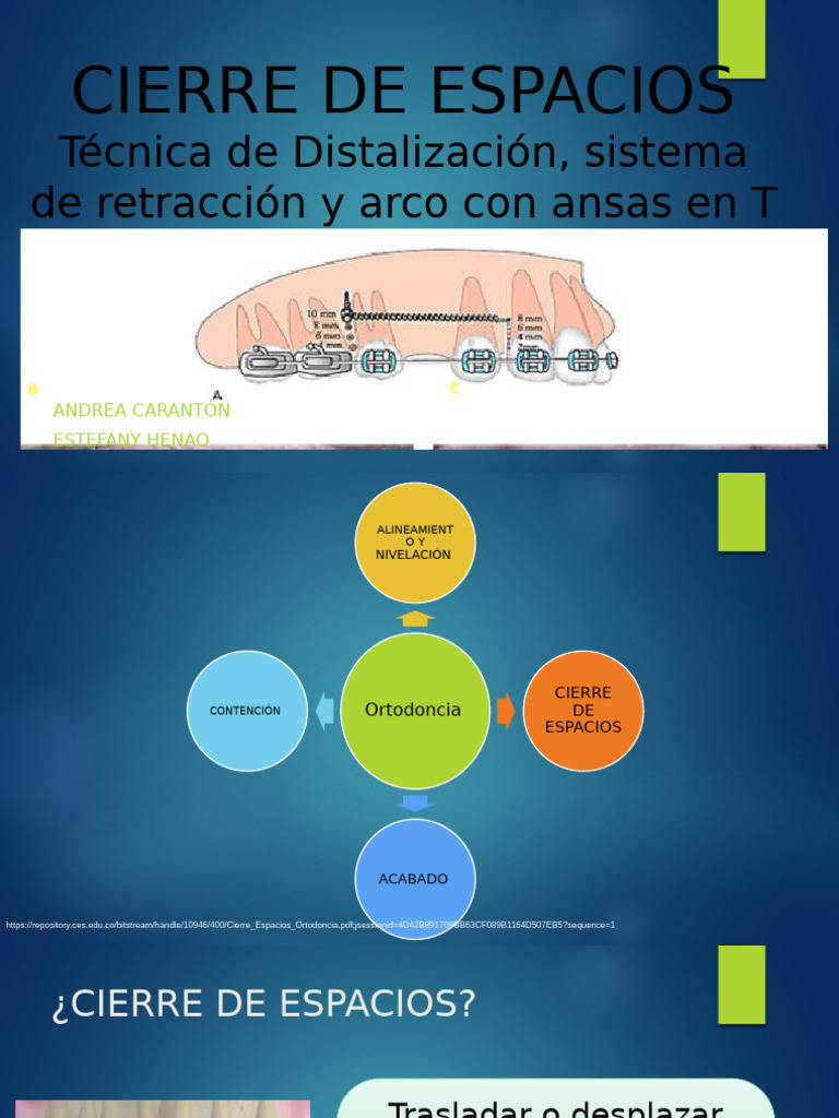 CIERRE DE ESPACIOS Técnica de Distalización, Sistema | PDF | Ortodoncia ...