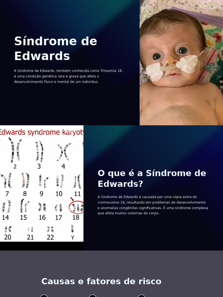 Síndrome de Edwards: Causas e Sintomas | PDF | Remédio | Medicina Clínica