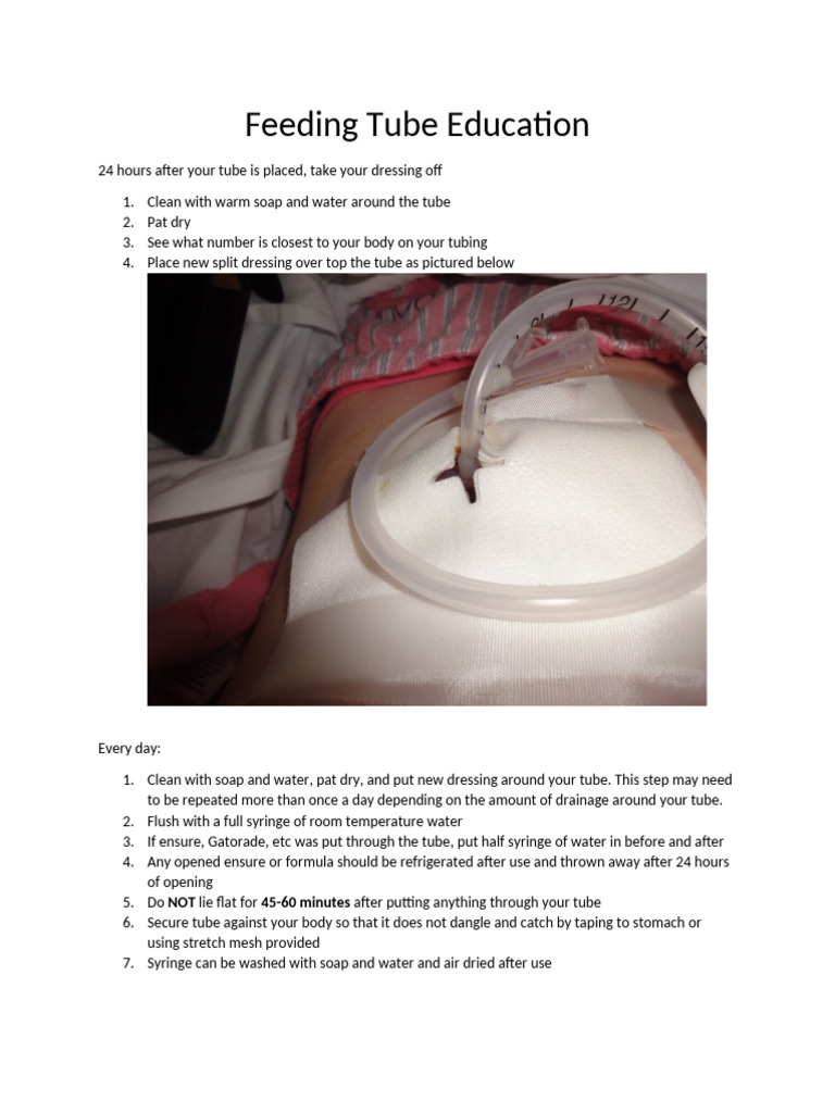 Tube Patient Education | PDF