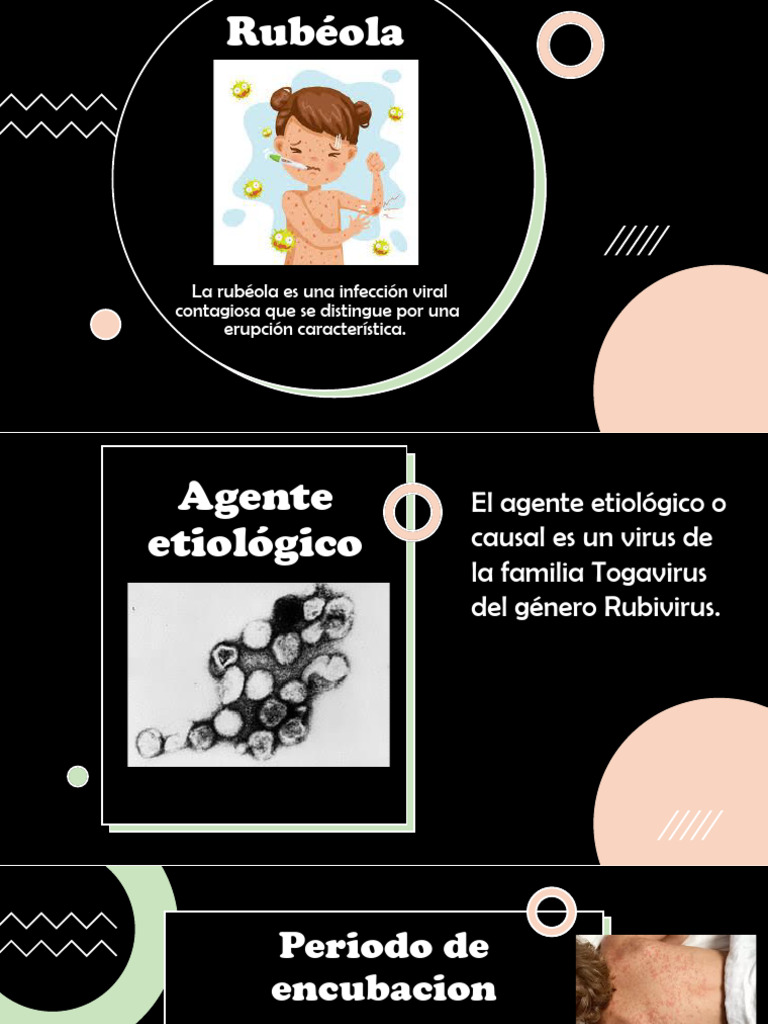 Rubeola | PDF | Enfermedades virales | Microbiología
