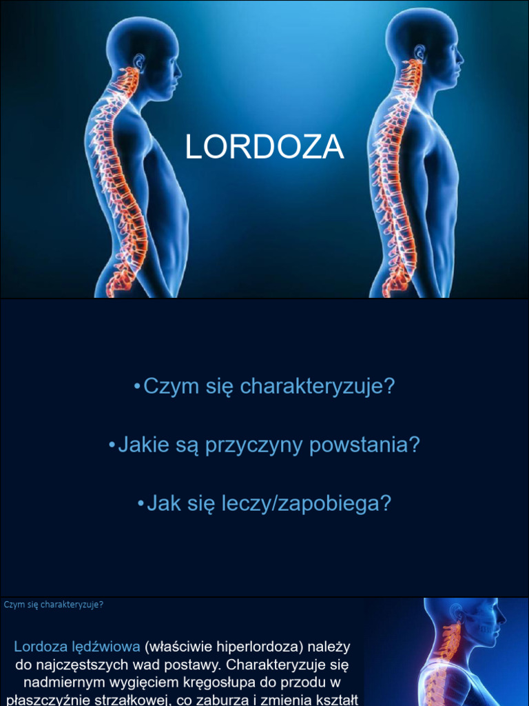 LORDOZA | PDF