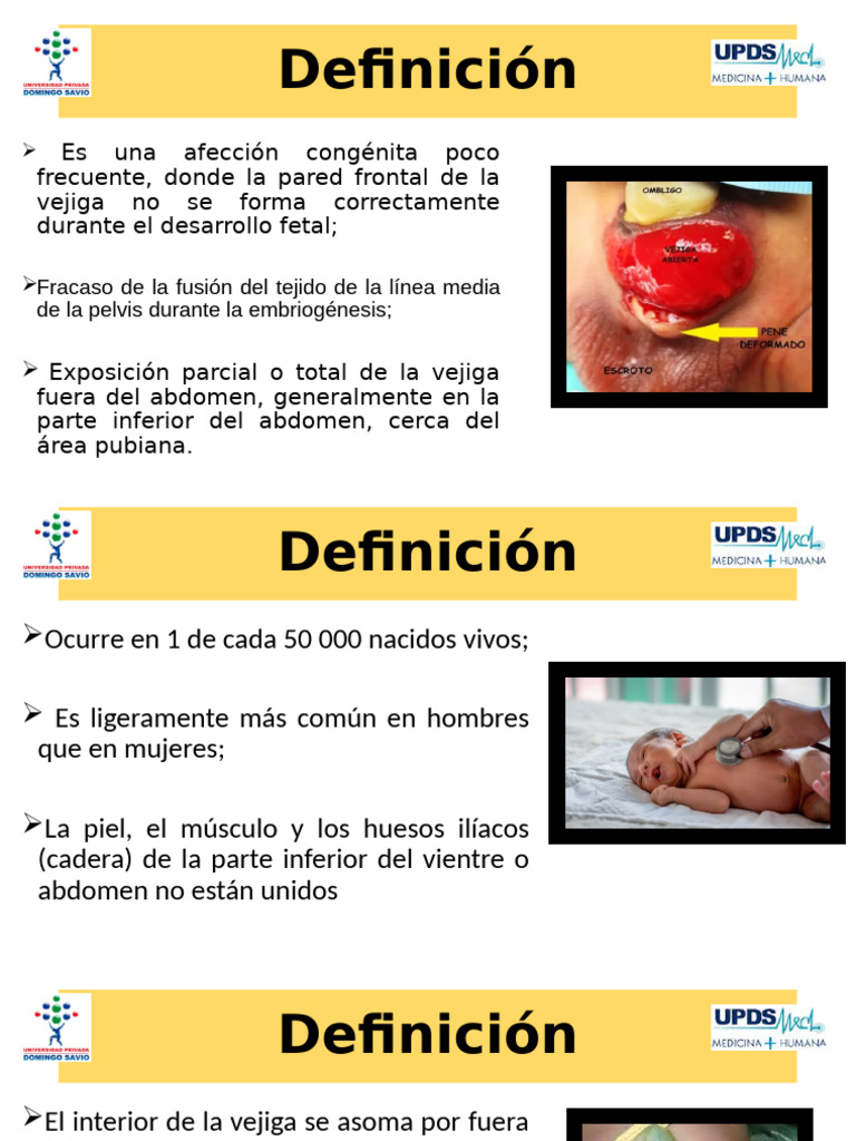 Extrofia Vesical | PDF | Abdomen | Especialidades Medicas