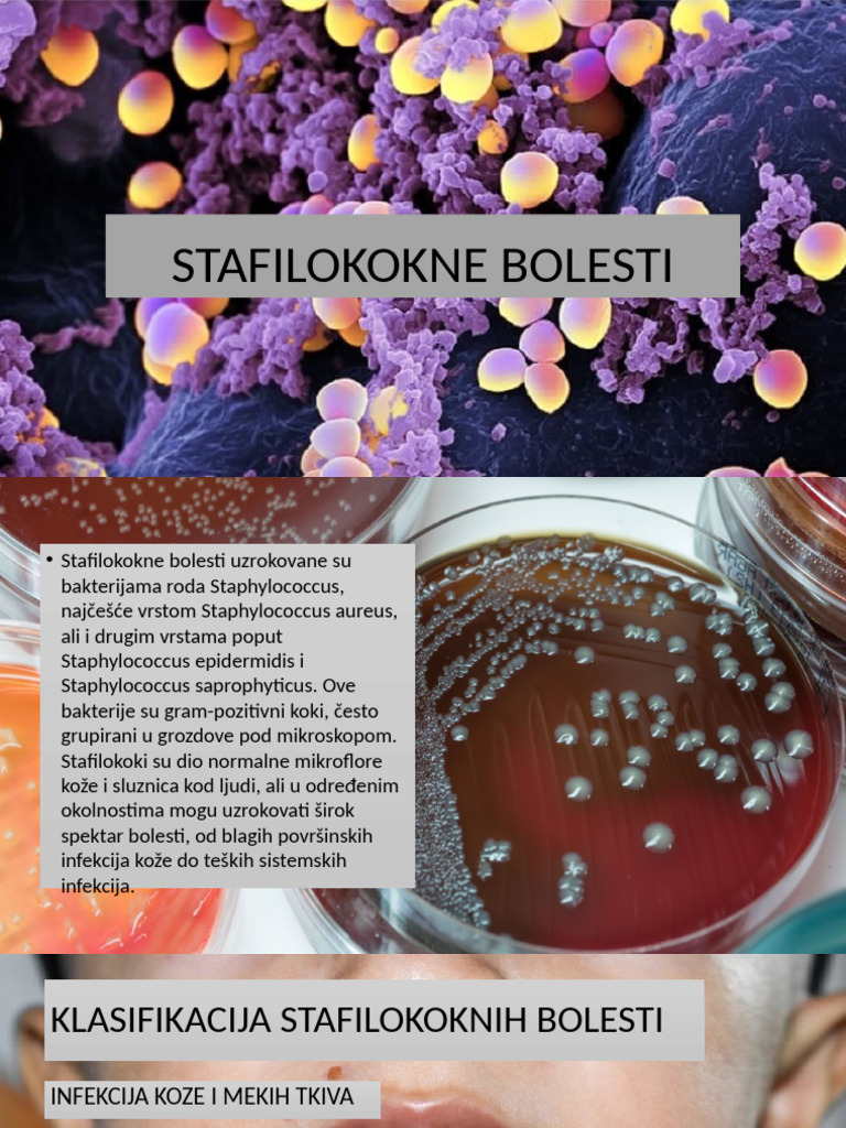 Stafilokokne Bolesti | PDF