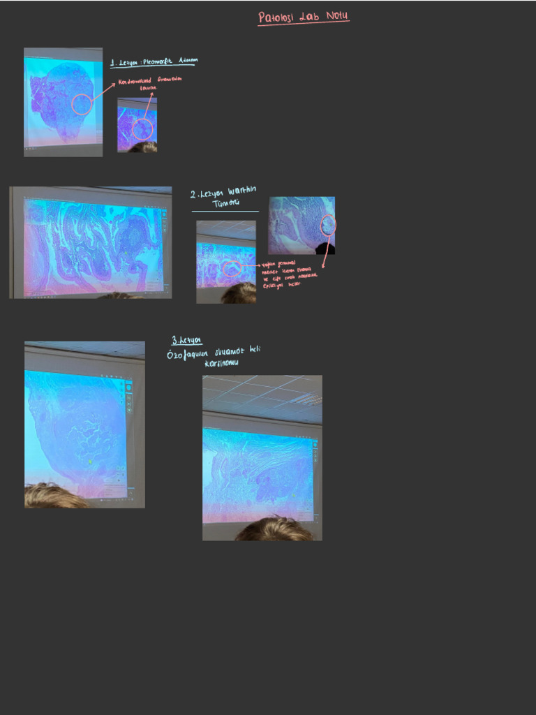 Dönem 3 Kurul 3 Patoloji Pratik Notu | PDF