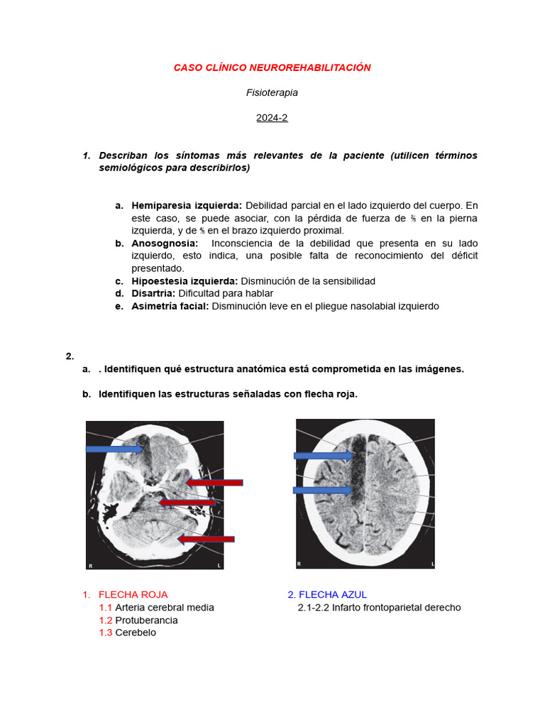 Rehabilitación Post-ACV: Caso Clínico | PDF | Lóbulo frontal | Cerebro