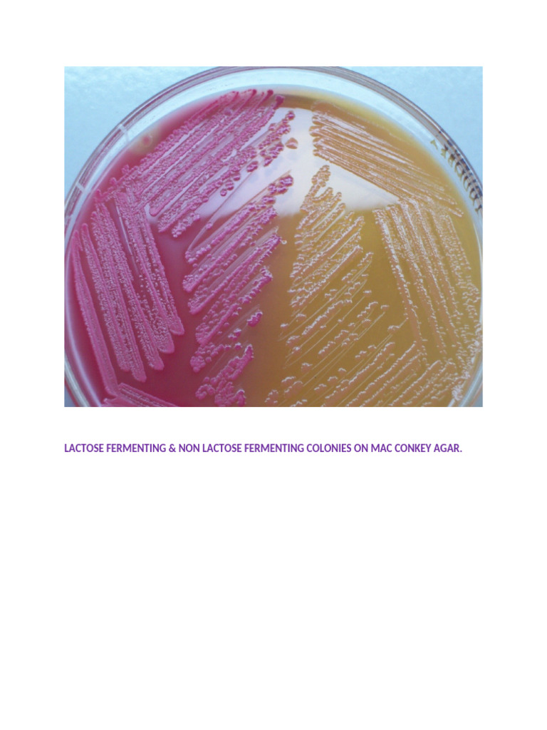 Bacterial Colony Identification Tests | PDF