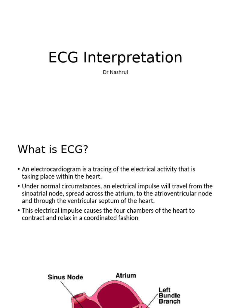 ECG Interpretation - Final | PDF | Electrocardiography | Heart