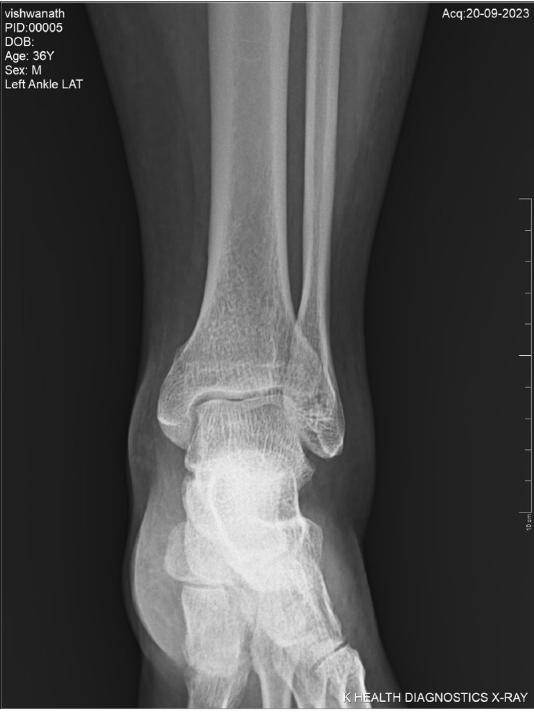 Vishwanath X Ray 1 | PDF