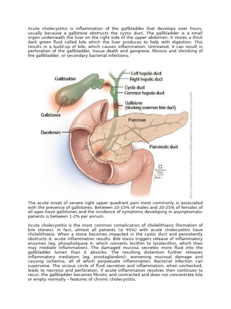 Acute Cholecystitis Overview | PDF | Gallbladder | Abdomen