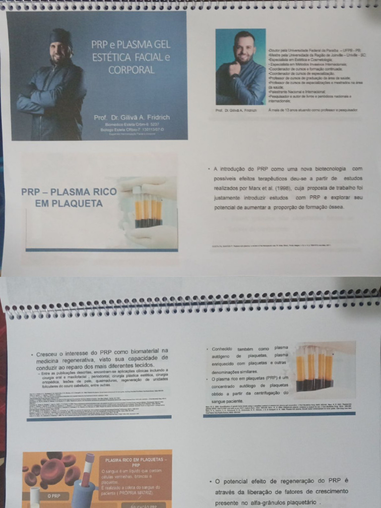 PRP e Plasma Gel | PDF