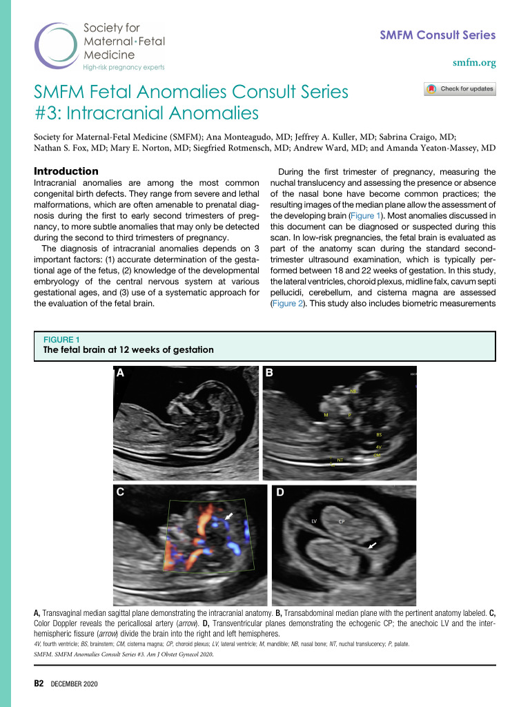 SMFM Fetal Anomalies 3 - Intracranial Anomalies (Monteagudo, AJOG, 2020 ...