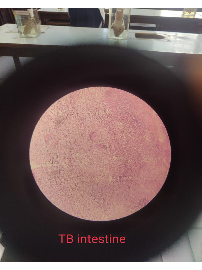 Patho Slides-1 | PDF