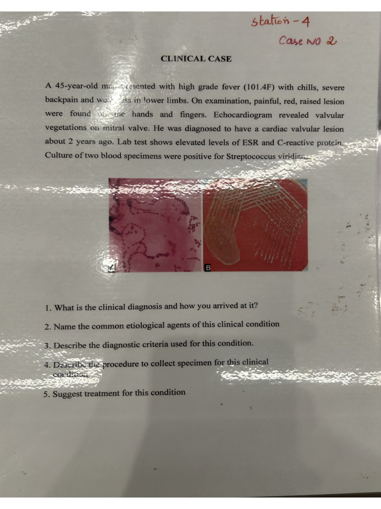 Micro Compressed | PDF