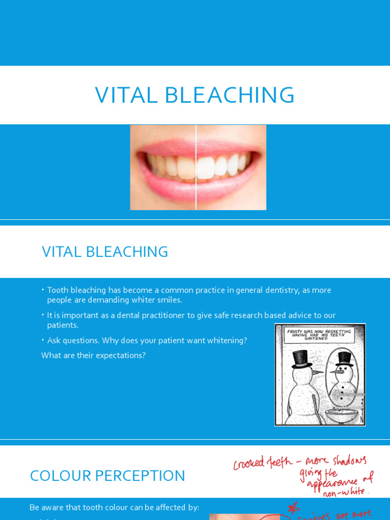 Essential Guide to Vital Tooth Bleaching | PDF | Human Tooth ...