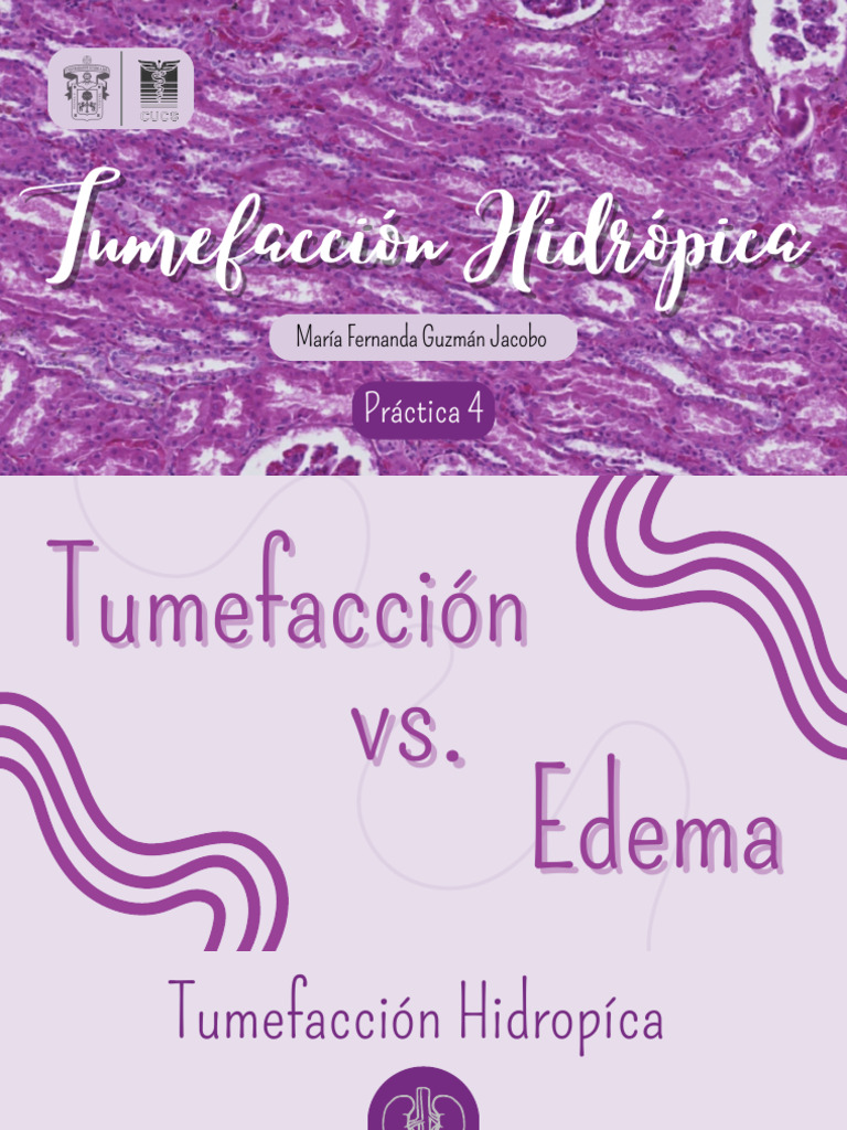 Lesión Celular: Tumefacción Hidrópica | PDF