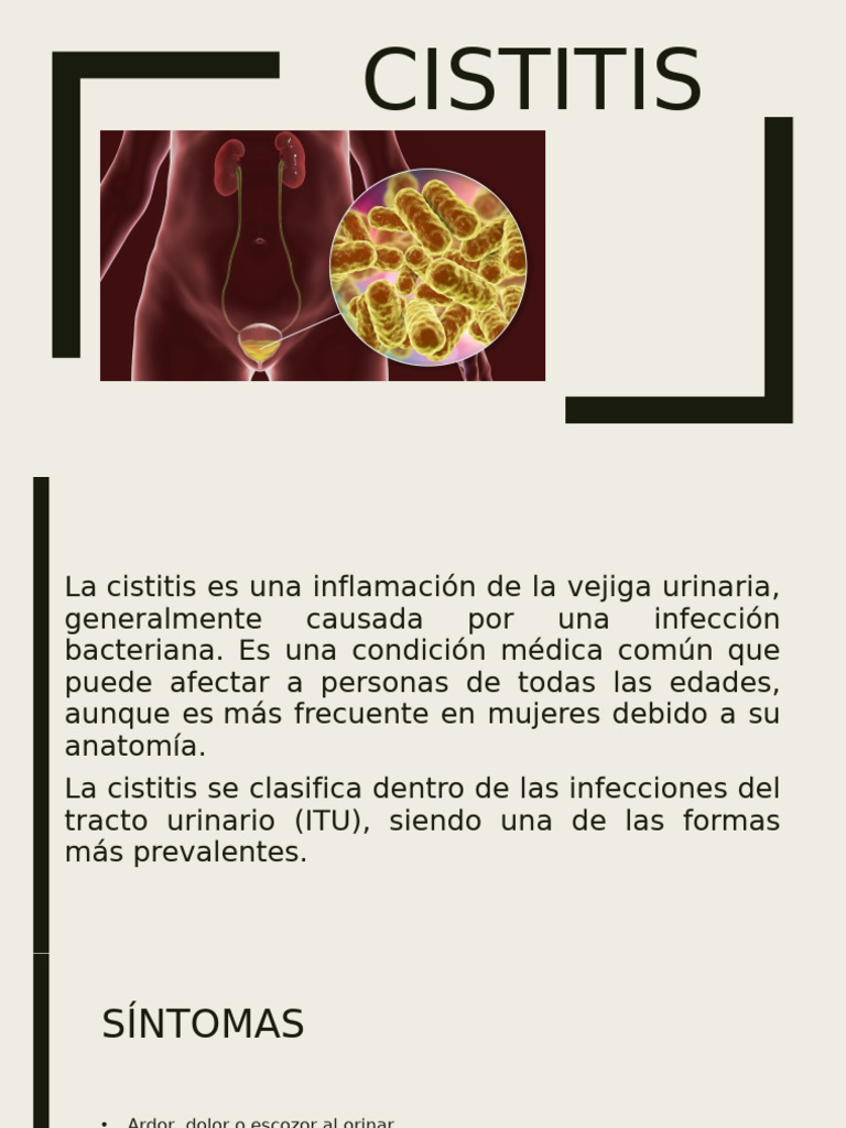 Cistitis y Uretritis | PDF | Infección del tracto urinario | Inmunología
