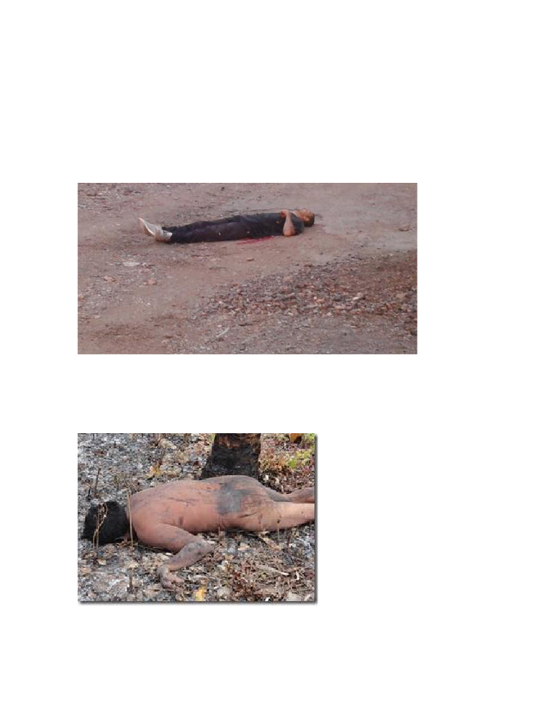 Posiciones Cadavericas | PDF