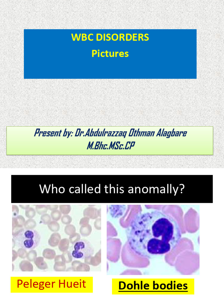 WBC disorders | PDF | Granulocyte | White Blood Cell
