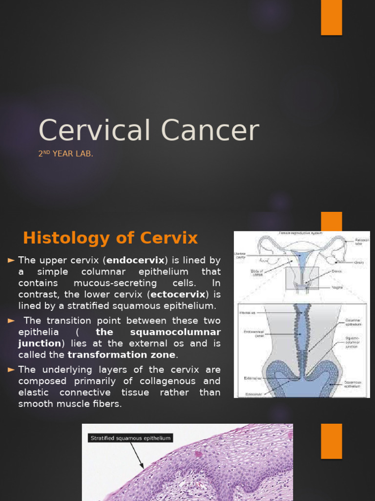 Cervical Cancer Lab 2025 | PDF | Epithelium | Histology