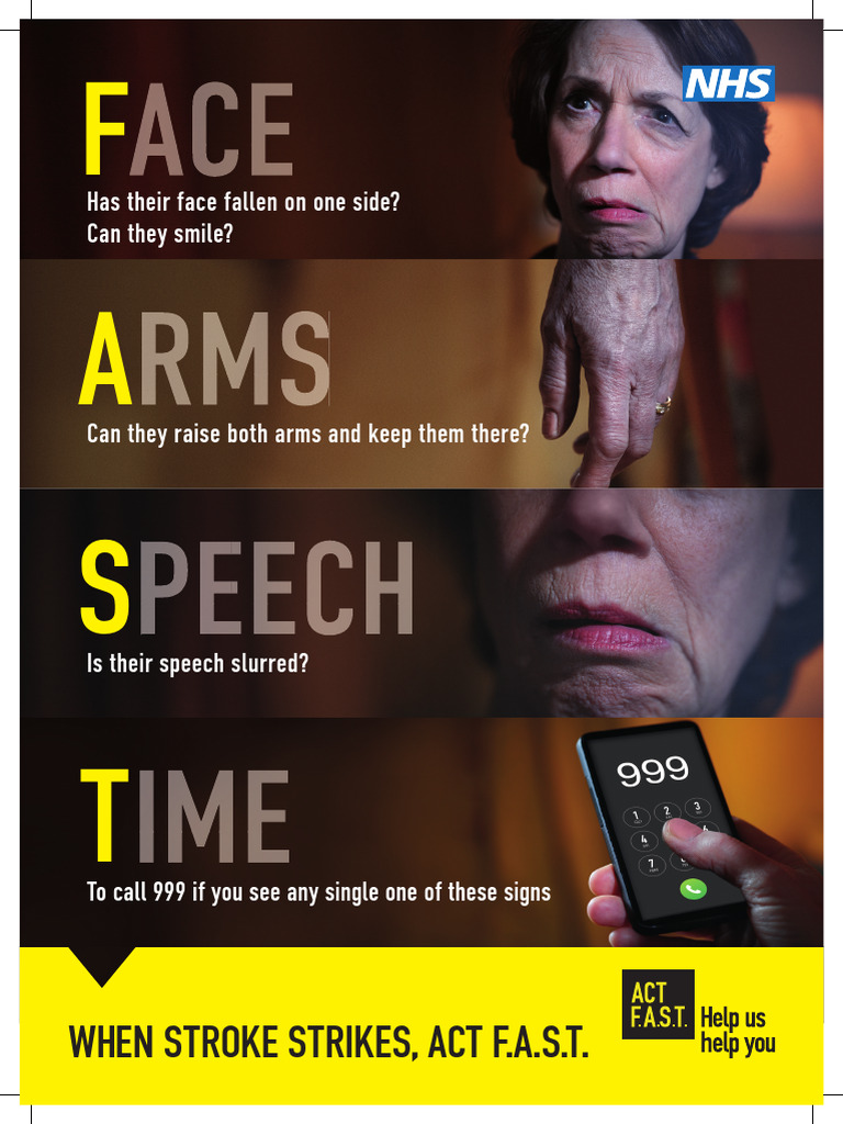 nhs-act-fast-stroke_Female_A4_Leaflet_HR | PDF | Stroke | Medical ...