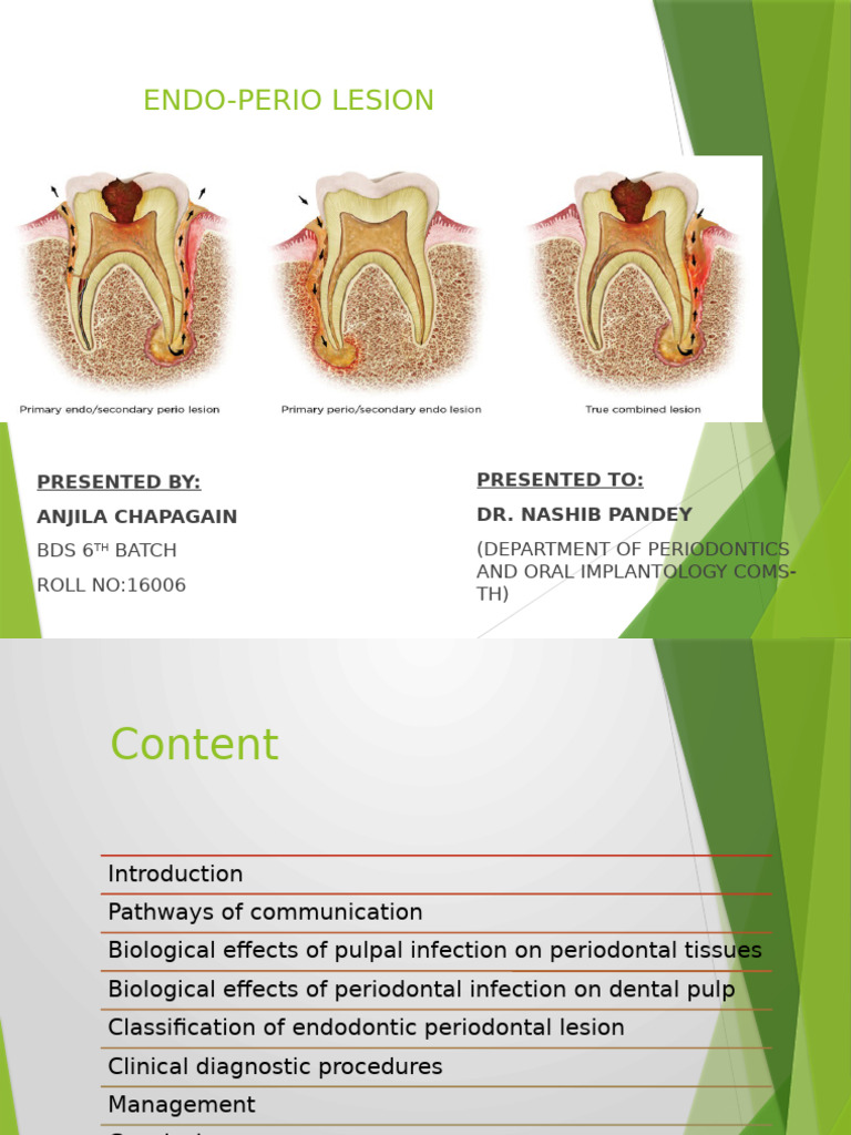 Endo Perio Lesion Perio | PDF | Periodontology | Dental Anatomy