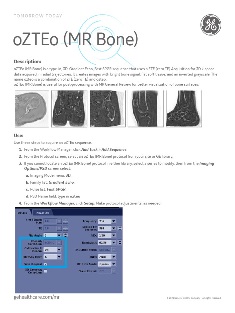 oZTEo - MR Bone QRG Rev 2 | PDF | Pixel | Display Resolution