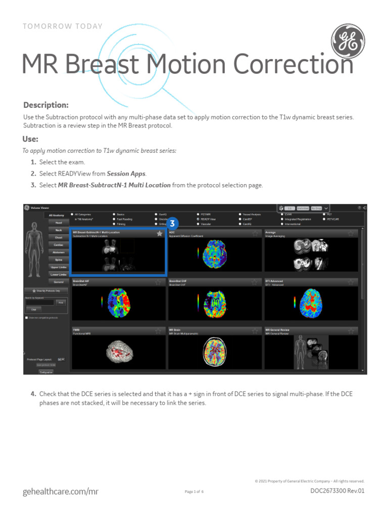MR Breast Motion Correction QRG | PDF | Specification (Technical ...