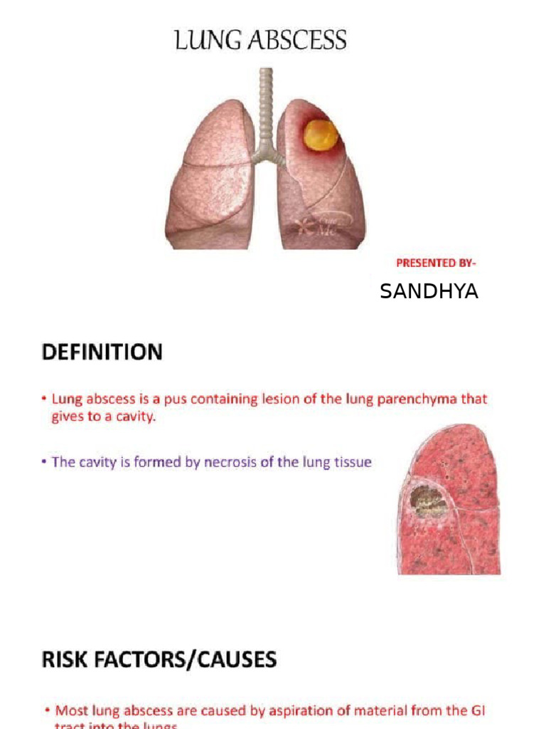 Lung Abcess | PDF