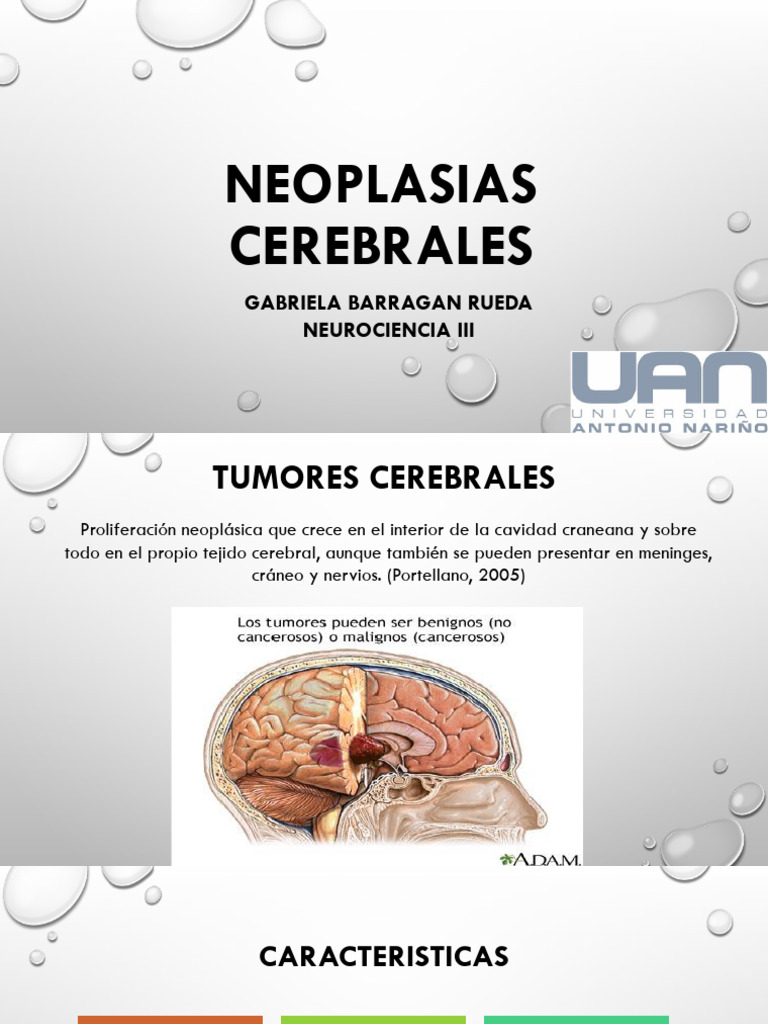 neoplasias, infección | PDF | Neoplasias | Cerebro