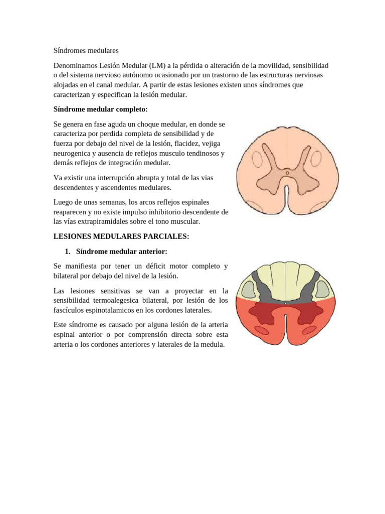 Síndromes Medulares | PDF